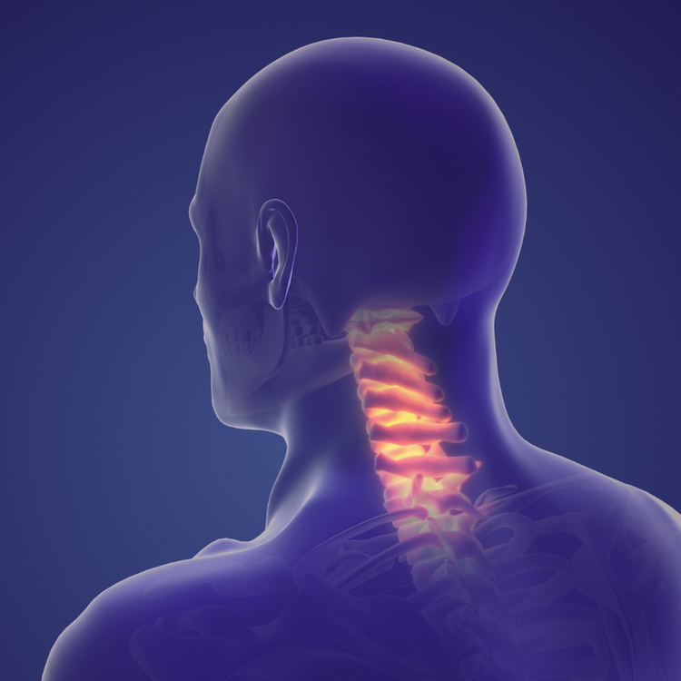 Arthrose cervicale : symptômes, causes et traitements efficaces – Ledoscare